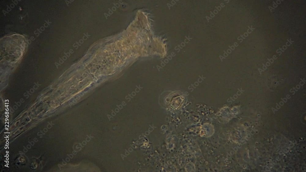 Microscopic Rotifera use cilia to filter feed, as seen through a phase ...