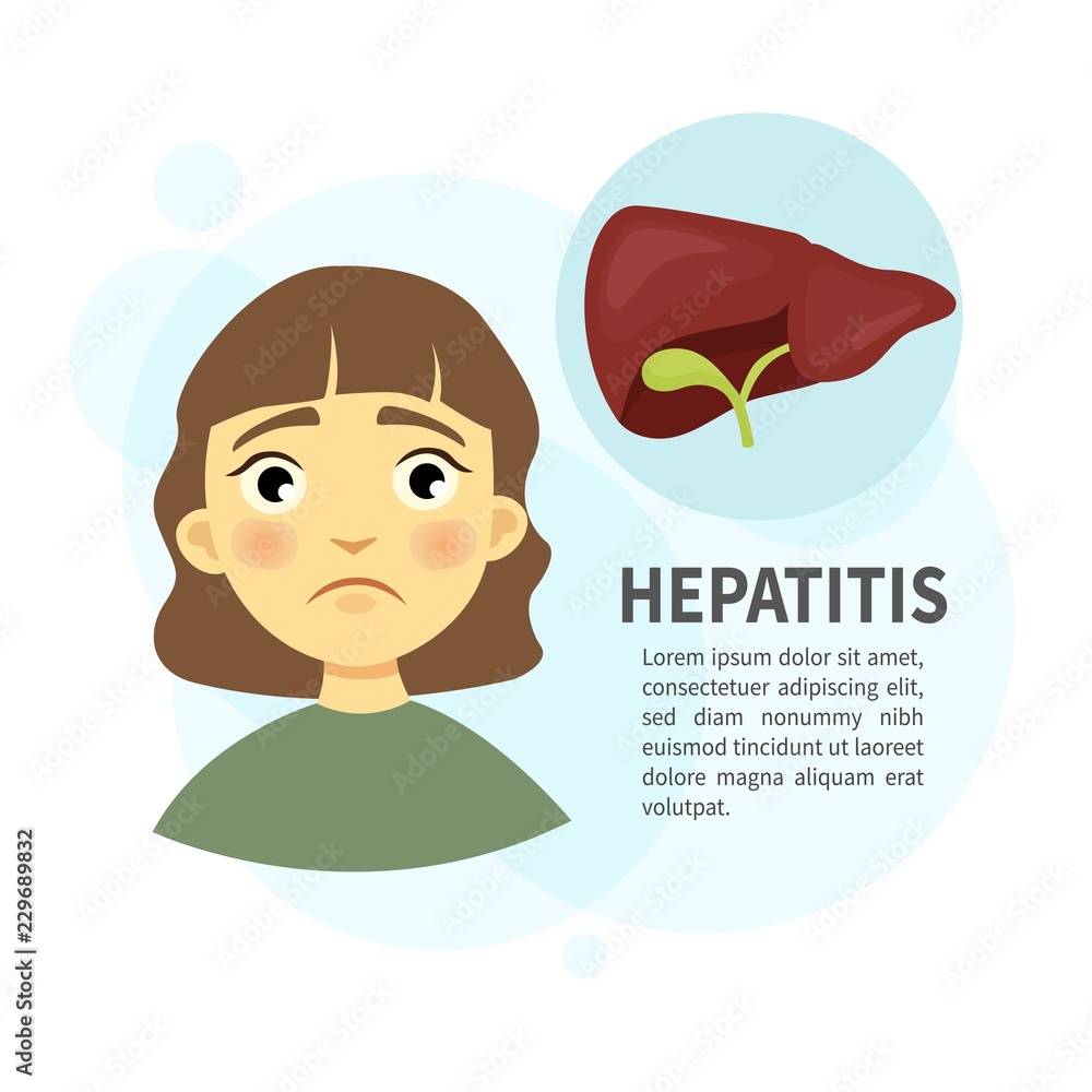 Infographics of liver disease. A cartoon cute girl. Stock Vector ...