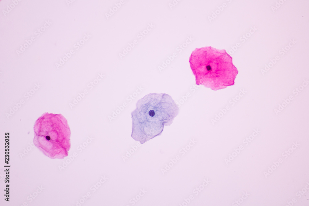 Stockfoto Normal squamous epithelial cells of cervical woman on white ...