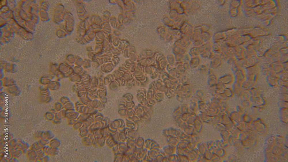 Blood, diseases, interstitial fluid, bacterial background, research ...