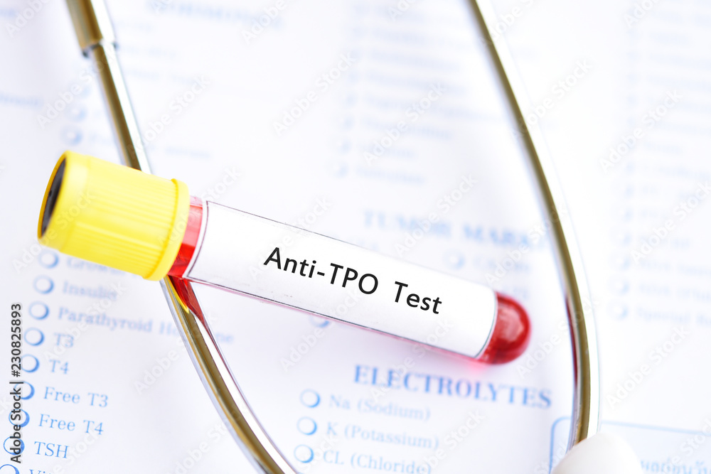 Blood sample tube for anti-TPO or anti-thyroid peroxidase test ...