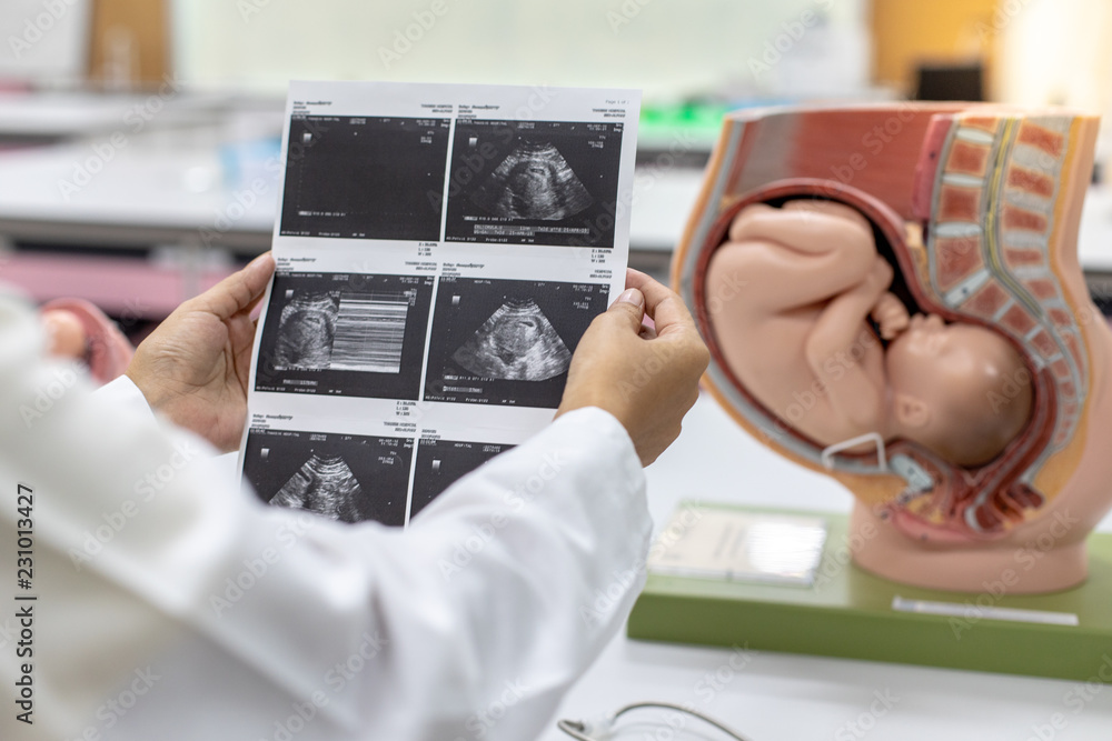 Ultrasound of baby in pregnant woman, Doctor reading test results of ...