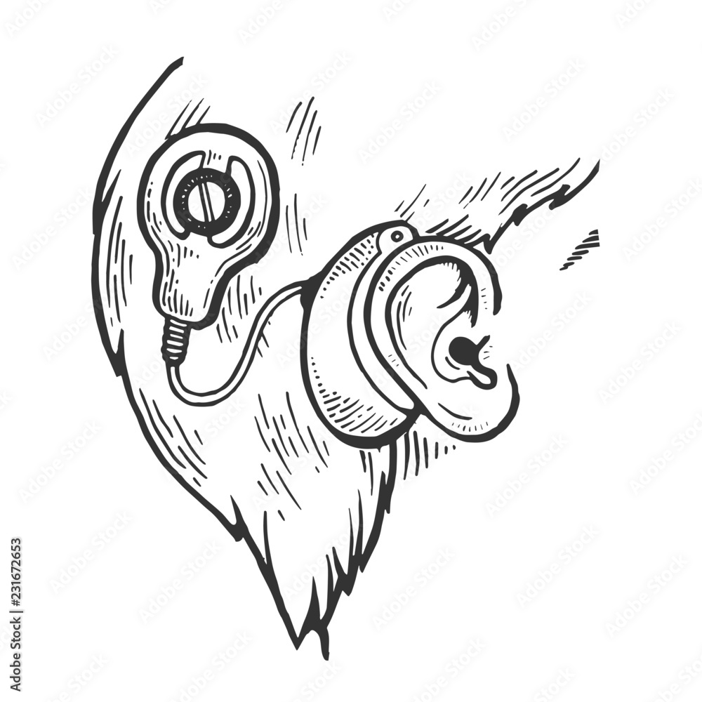 Cochlear implant on child head engraving vector illustration. Scratch ...