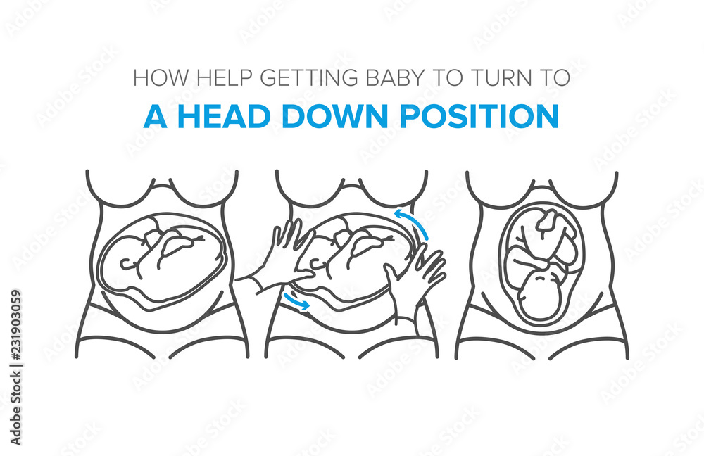 Head Down Position