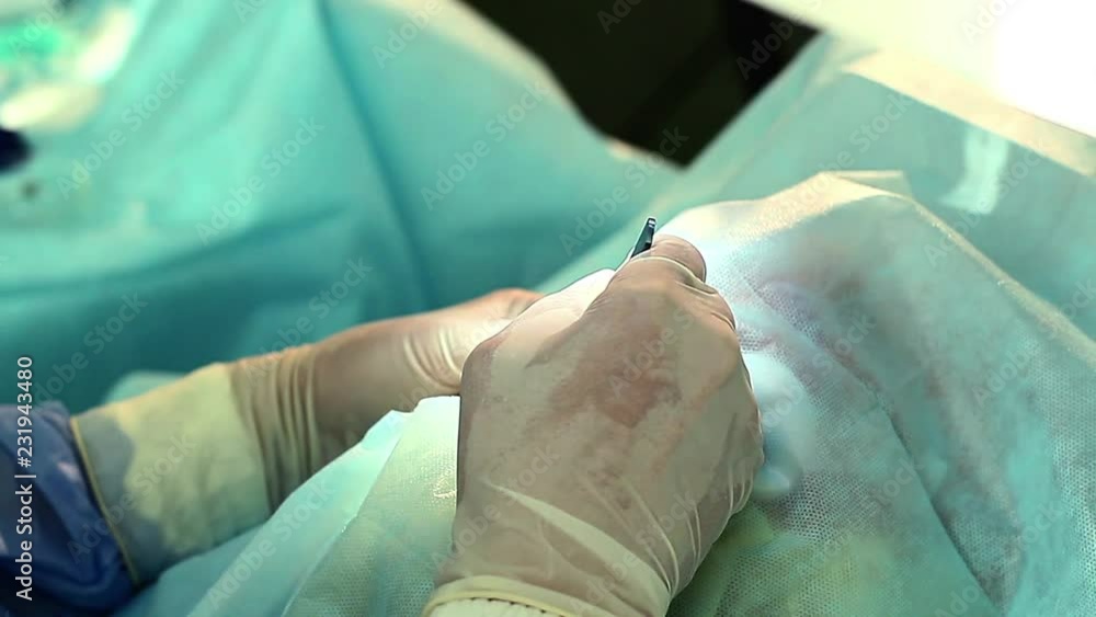 doctor hands on the ophthalmic operating, The operation on the eye ...