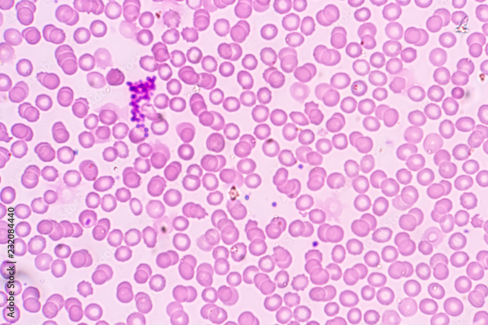 Study of white blood cells are the cells of the immune system under the ...