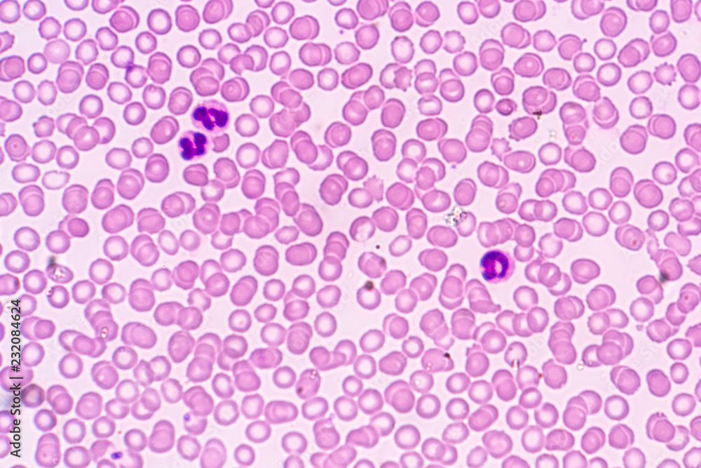 Study of white blood cells are the cells of the immune system under the ...