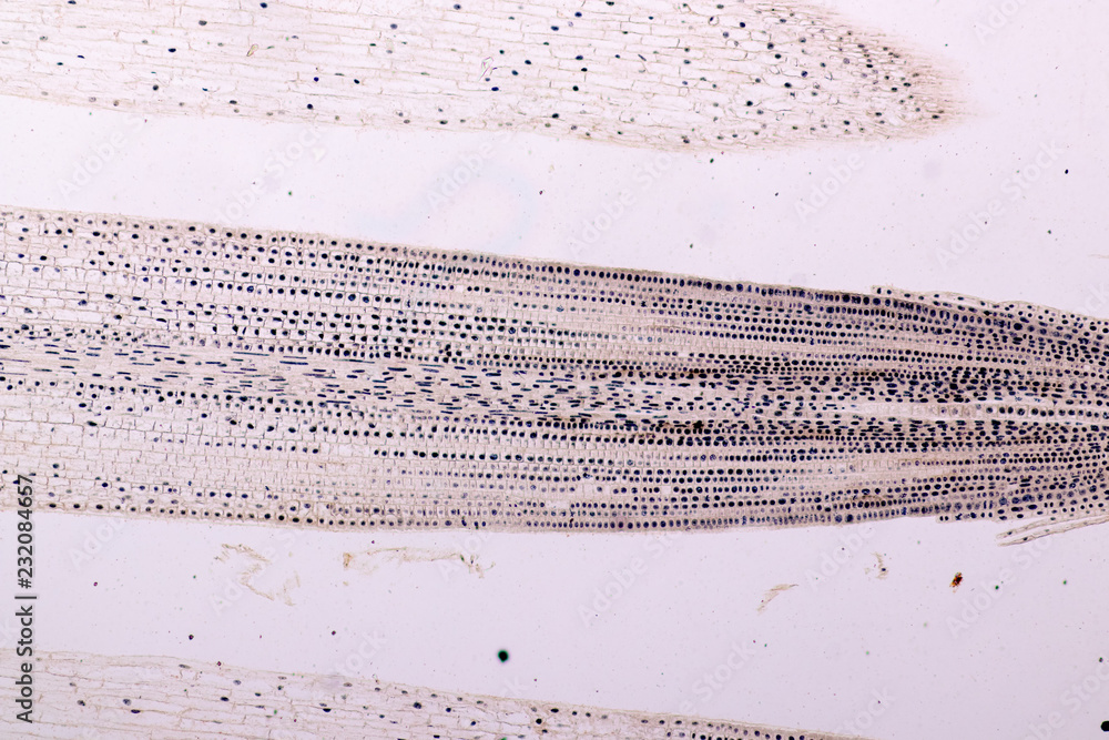 Onion Root Cells Under Microscope