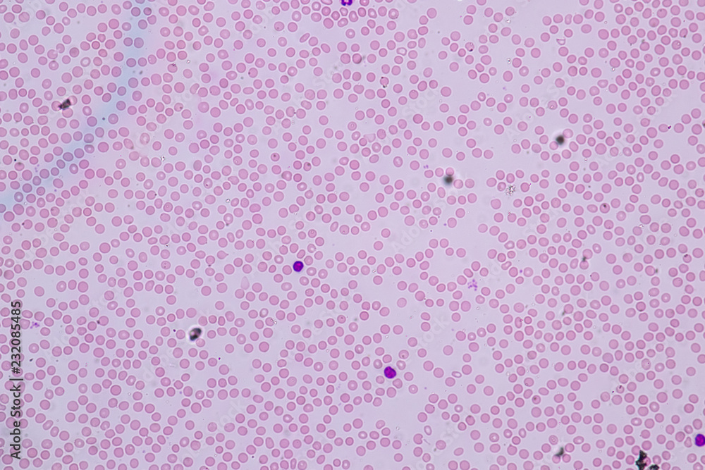 Study of white blood cells are the cells of the immune system under the ...