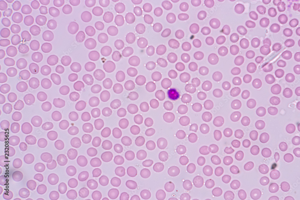 Study of white blood cells are the cells of the immune system under the ...