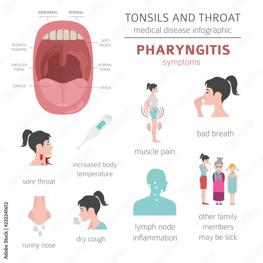 Tonsils and throat diseases. Pharyngitis symptoms, treatment icon set ...