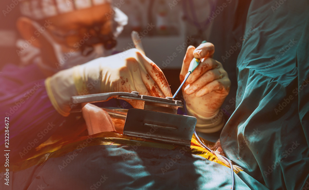 Heart surgery during open-heart surgery in operating room Stock Photo ...