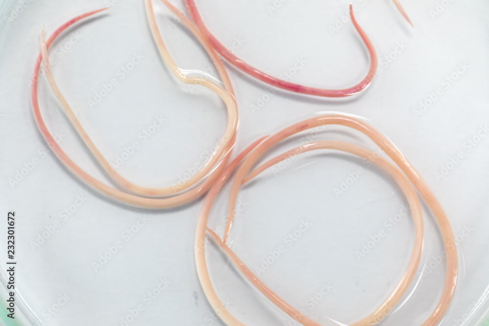 Ascariasis is a disease caused by the parasitic roundworm Ascaris ...