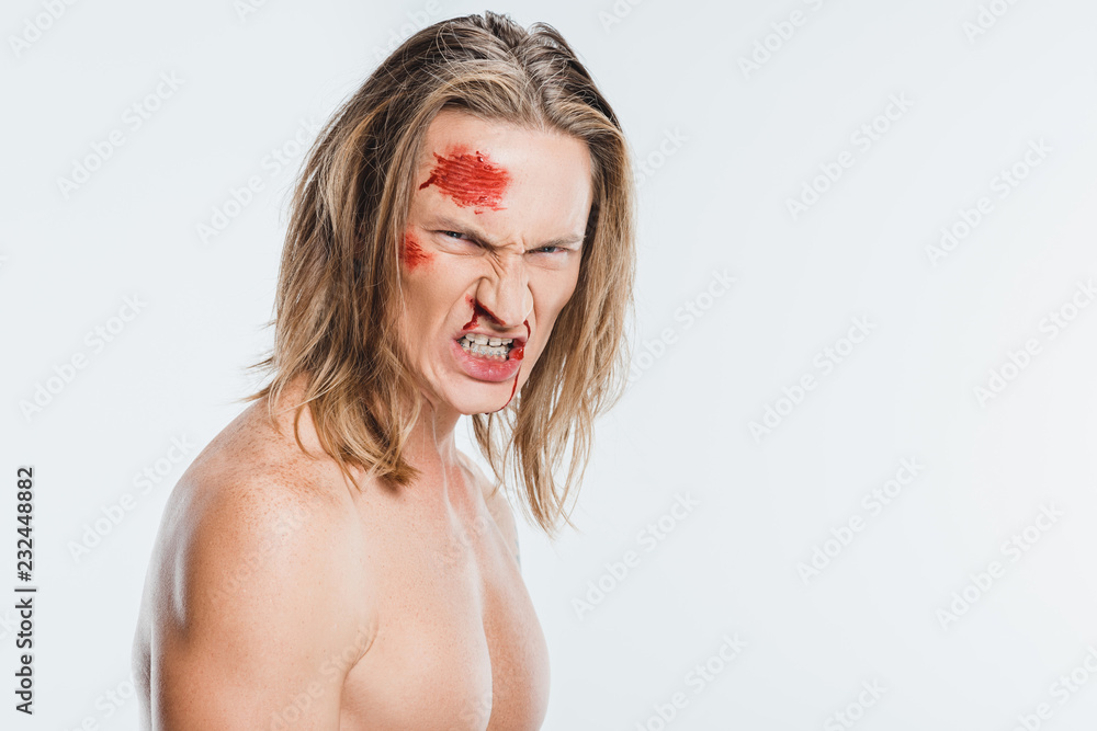 angry man with bloody wounds on face showing teeth isolated on white ...