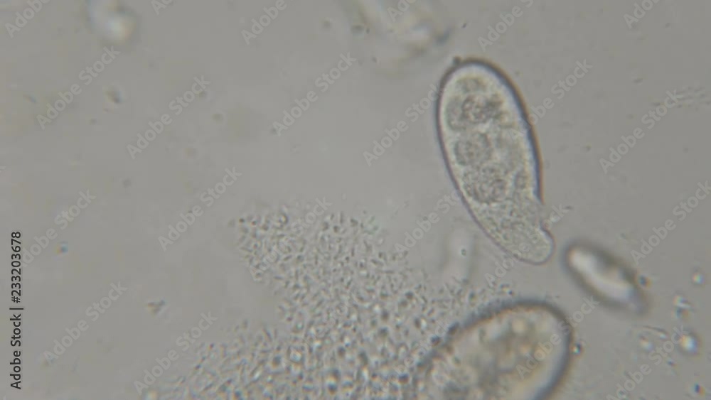 Motion of single-celled animals (infusoria) under microscope. Colony of ...