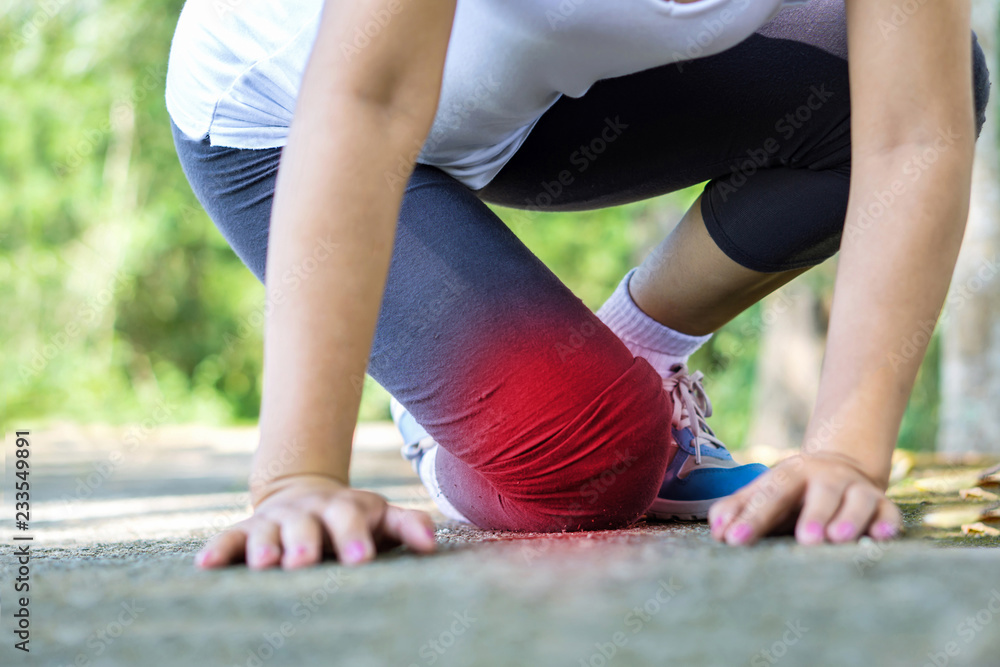 female runner falling and having knee pain , sport injury accident ...
