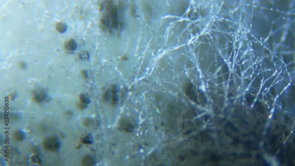 Black Mold taken from rotten bread , under a microscope. Colony of mold ...