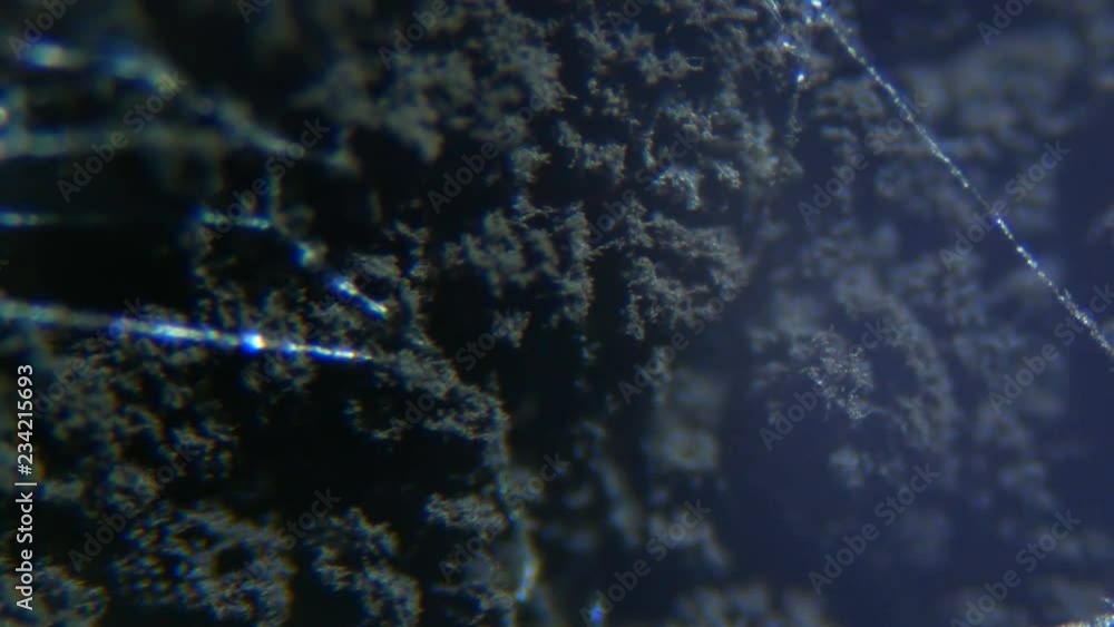 Black Mold taken from rotten bread , under a microscope. Colony of mold ...