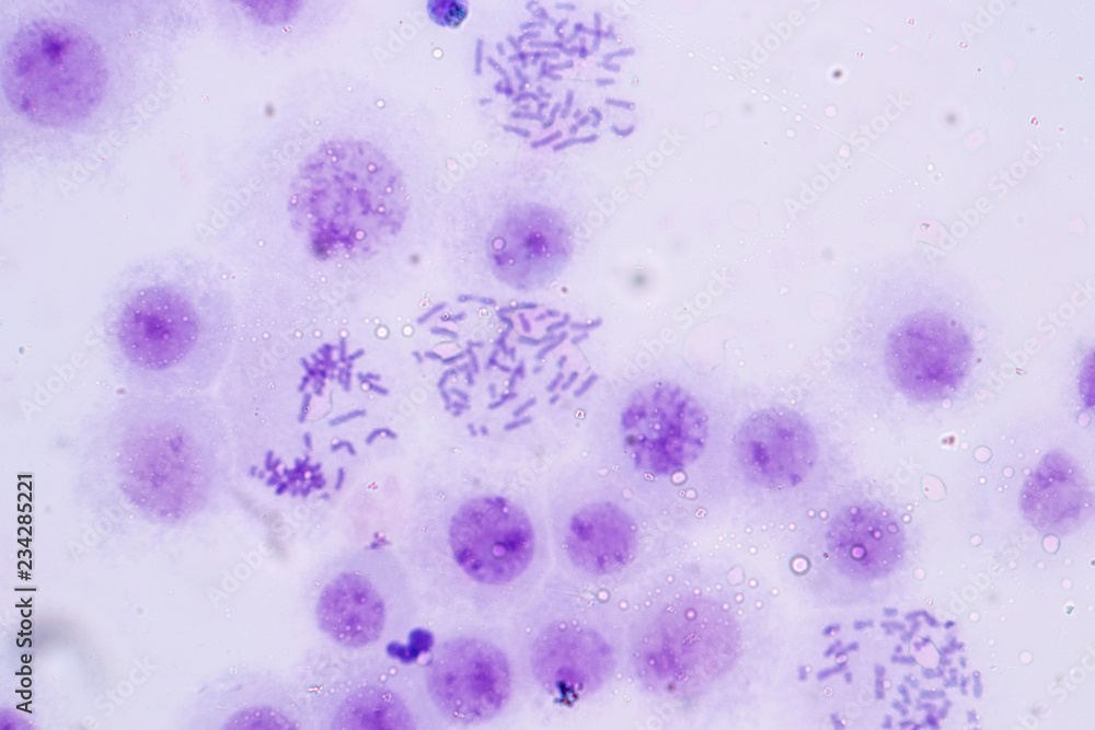 Chromosomes Human under the microscope for education in Lab. Stock ...