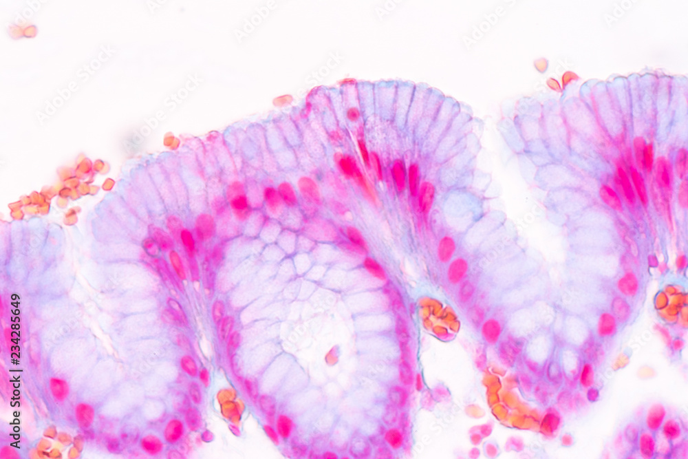 Tissue of Stomach under the microscope for education in Lab. Stock ...