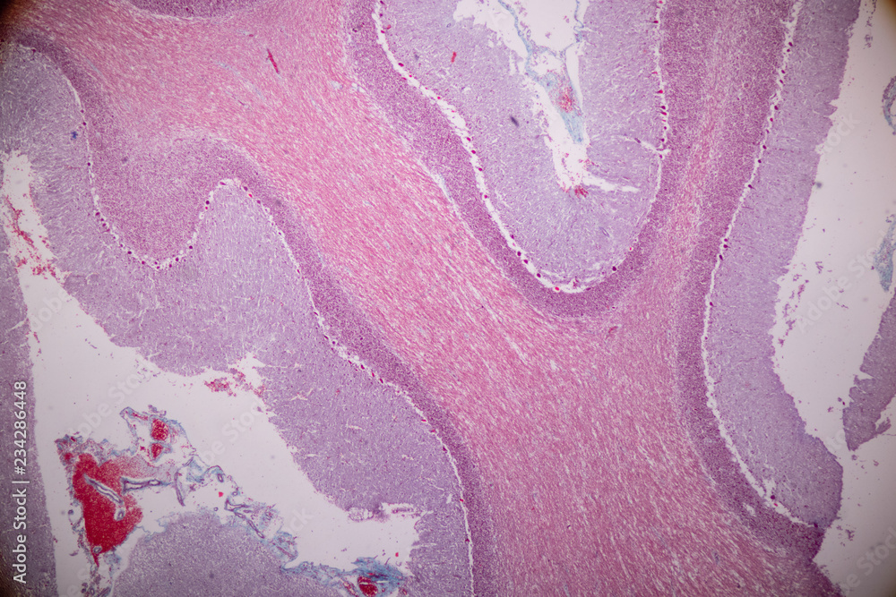 Cross section of the Cerebellum and Nerve human under the microscope ...