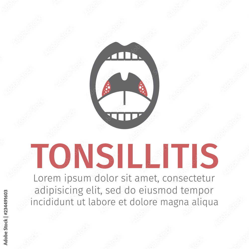 Tonsillitis icon Vector sign for web graphic. Stock Vector | Adobe Stock