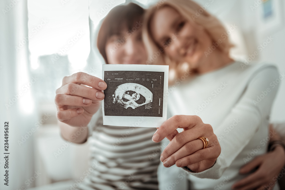 Future mothers. Two joyful ladies carrying black and white picture of ...