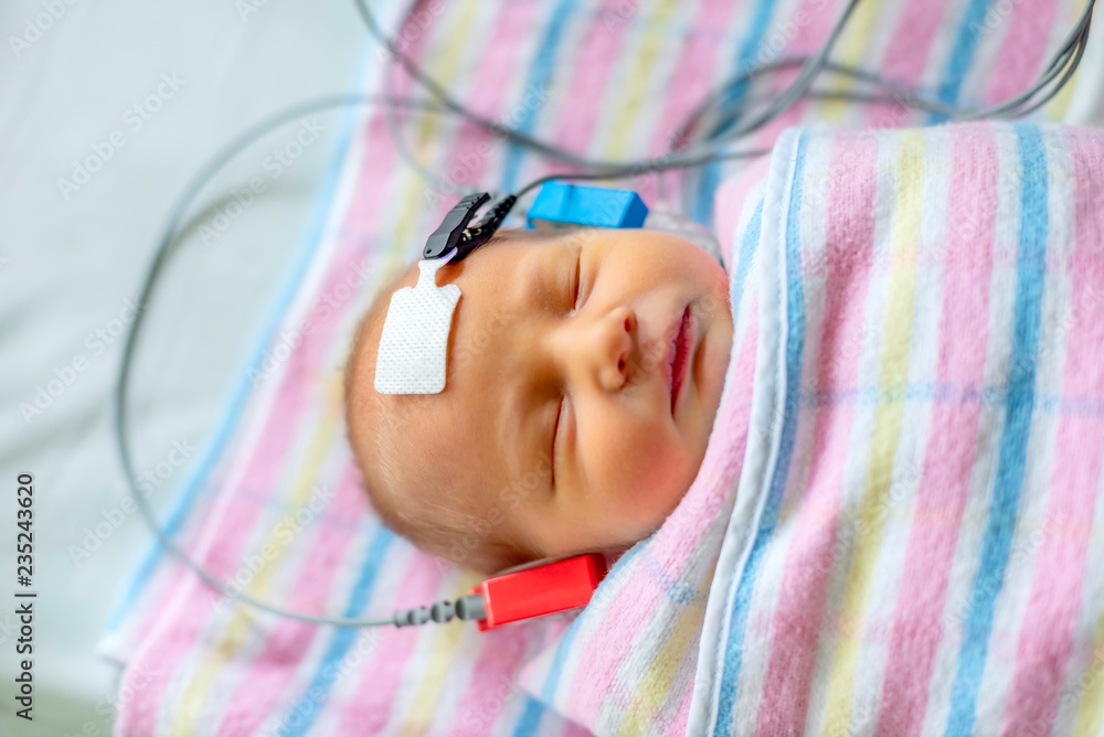hearing test of a sleeping newborn at hospital Stock Photo | Adobe Stock