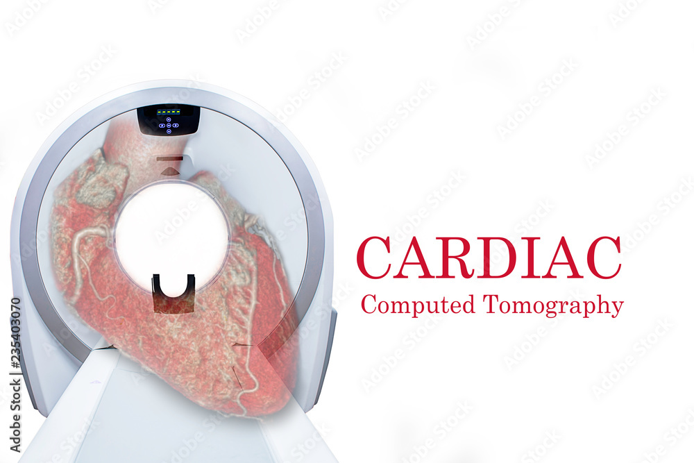 CTA Coronary artery 3D rendering image. Cardiac CT for heart disease ...
