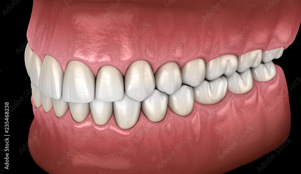 Foto de Healthy human teeth with normal occlusion, side view. Medically ...