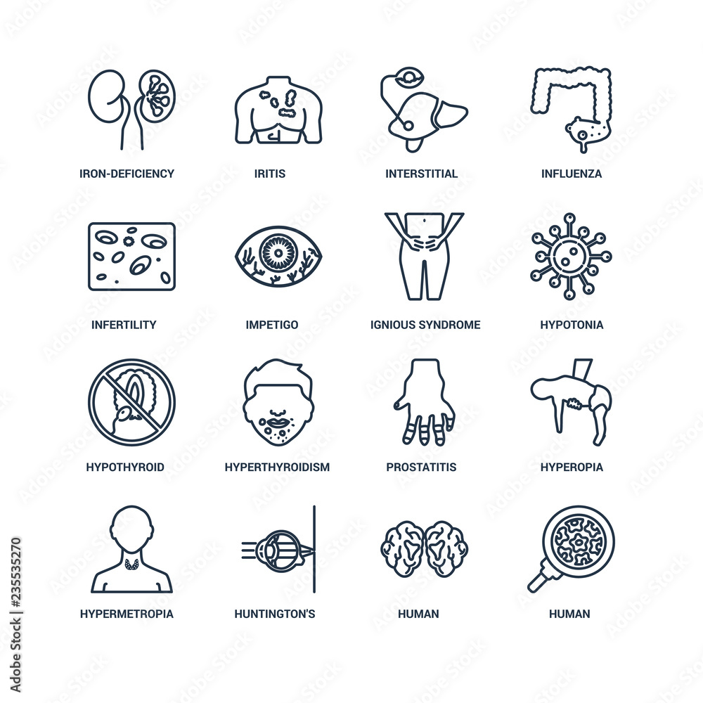 Human papillomavirus, papillomavirus (HPV), Huntington's disease Stock ...