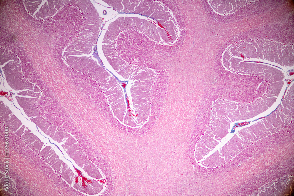 Foto de Cross section of the Cerebellum and Nerve human under the ...