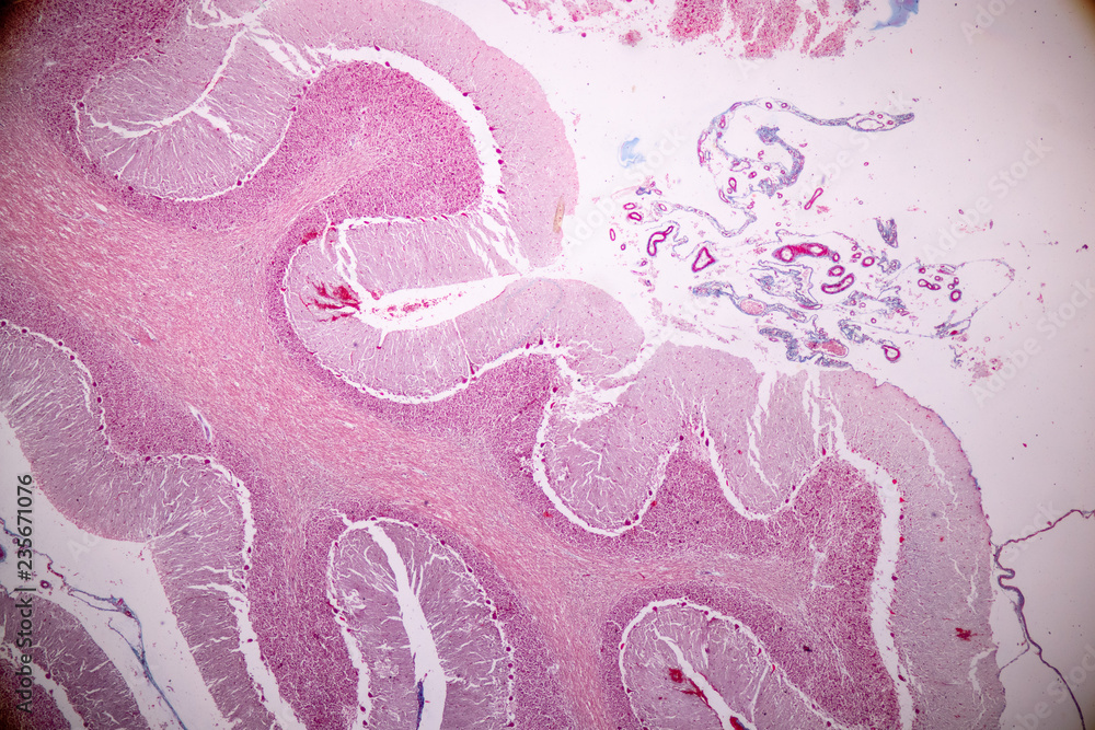 Cross section of the Cerebellum and Nerve human under the microscope ...