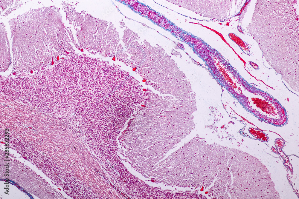 Cross section of the Cerebellum and Nerve human under the microscope ...