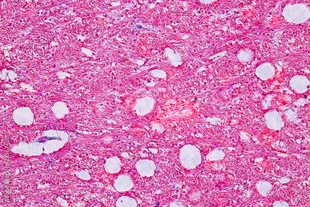 Cross section of the Cerebellum and Nerve human under the microscope ...