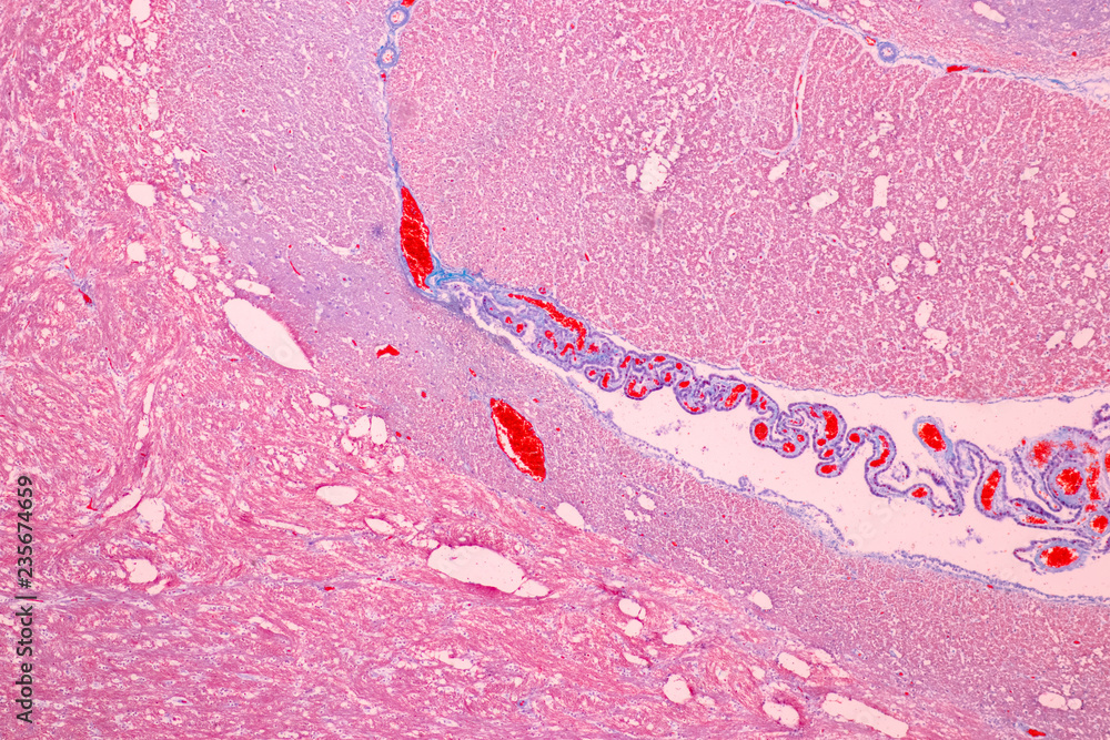 Cross section of the Cerebellum and Nerve human under the microscope ...