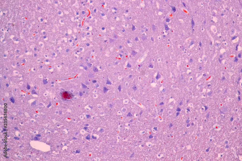 Cross section of the Cerebellum and Nerve human under the microscope ...