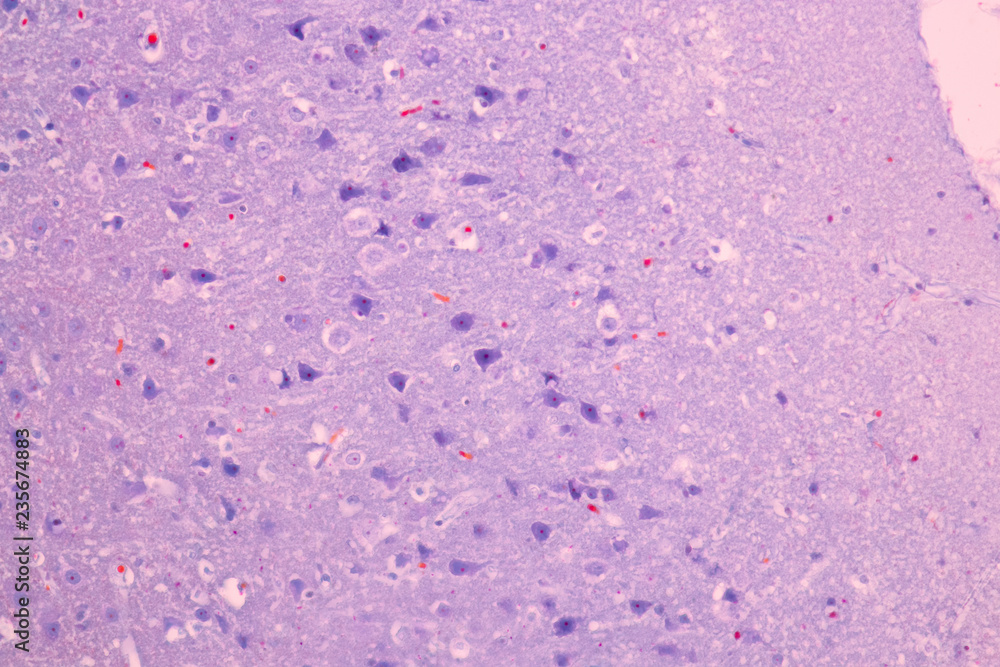 Cross section of the Cerebellum and Nerve human under the microscope ...