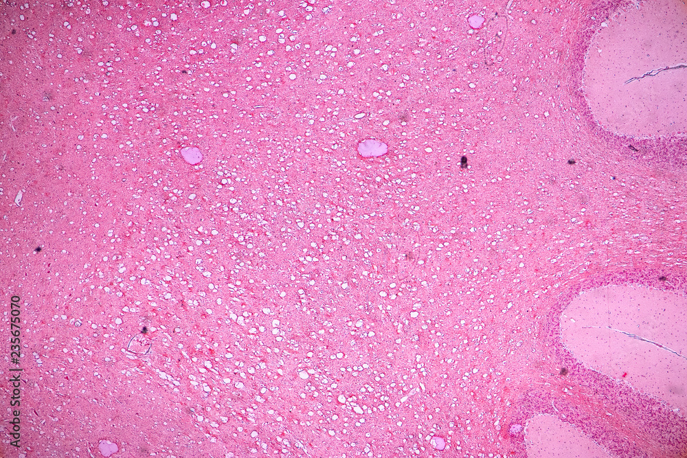 Cross section of the Cerebellum and Nerve human under the microscope ...