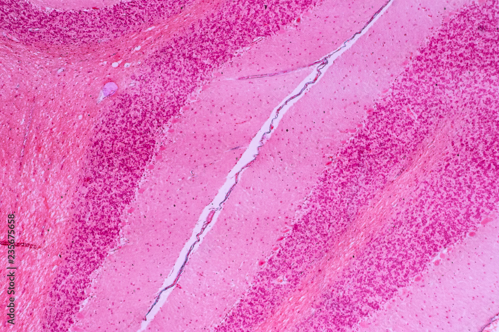 Cross section of the Cerebellum and Nerve human under the microscope ...