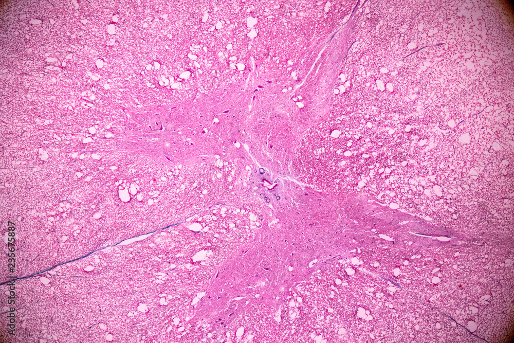 Foto de Cross section of the Cerebellum and Nerve human under the ...