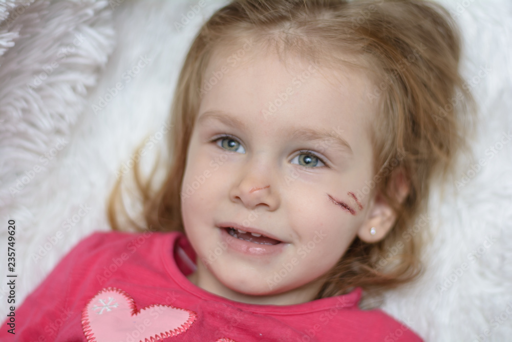 Physical injury blood wound skin child pain, Inflicted on the child's ...