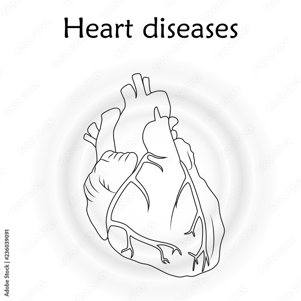 Heart diseases. Heart muscle. Anatomy flat illustration. Outline image ...
