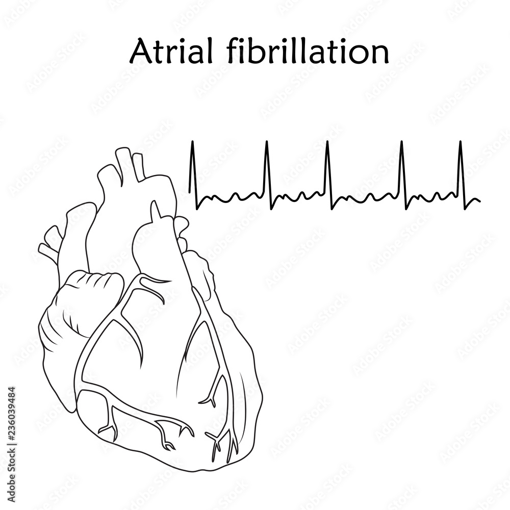 Human heart. Atrial fibrillation. Anatomy flat illustration. Outline ...