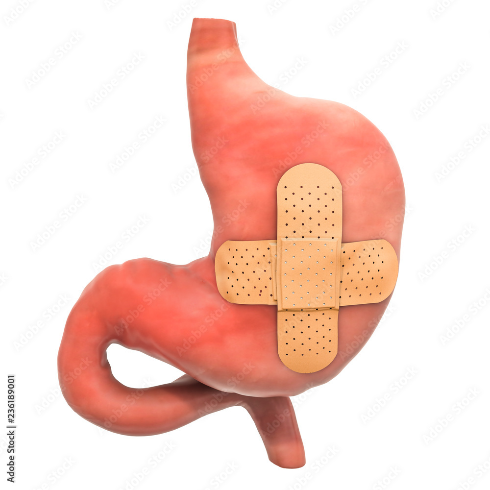 Human stomach with adhesive bandages. Treatment of stomach concept, 3D ...