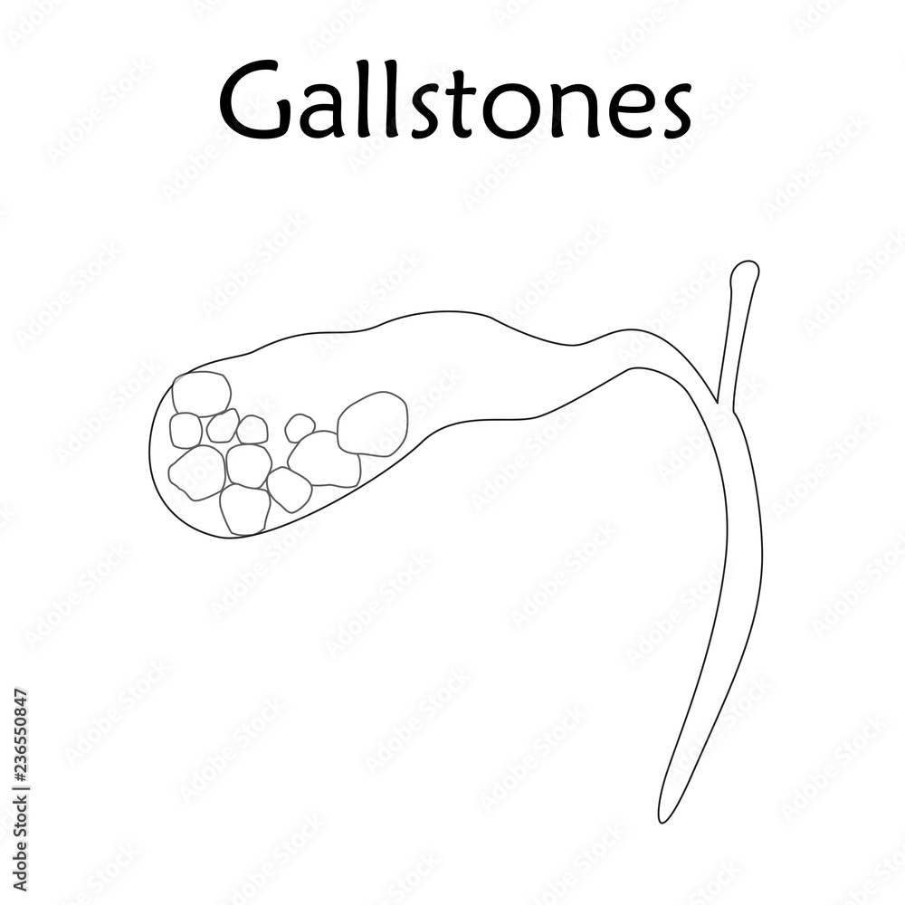 Gallbladder Drawing