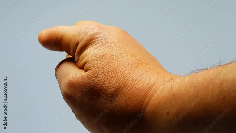 White adult male with partial amputation to the index finger of the ...