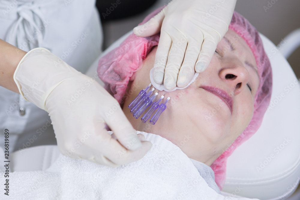 Aged woman doing mesothreads and Thread Lifting, Cosmetology. Cosmetic ...