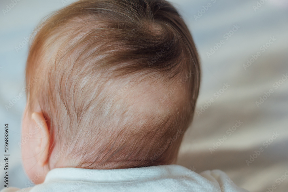 Back Of Head Looking Up