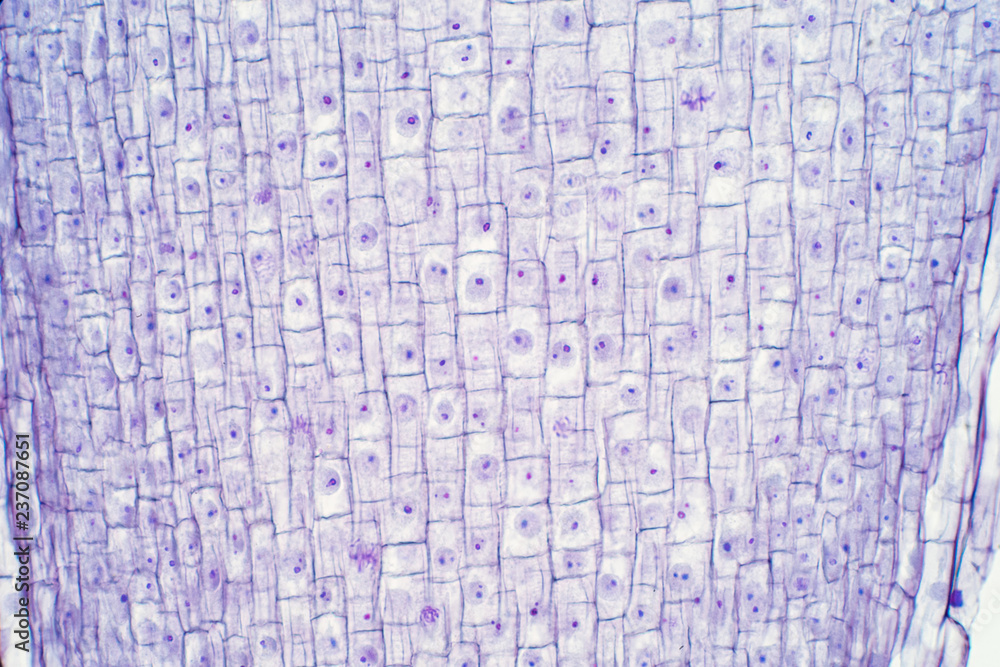 Root tip of Onion and Mitosis cell in the Root tip Stock Photo | Adobe ...